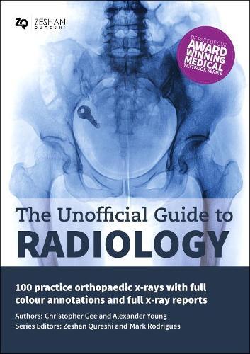The Unofficial Guide to Radiology: 100 Practice Orthopaedic X Rays with ...